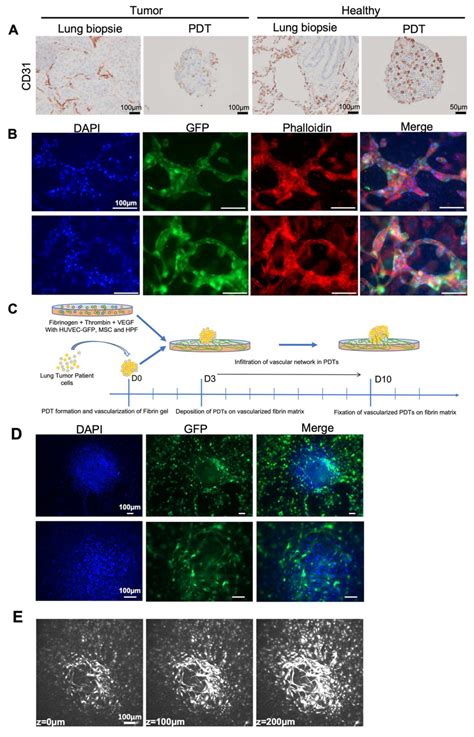 Endothelial Cells Infiltrate Pdt From Normal Vascular Microenvironment