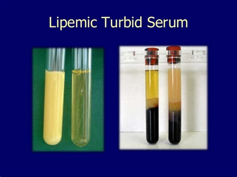 Lipids Made Simple