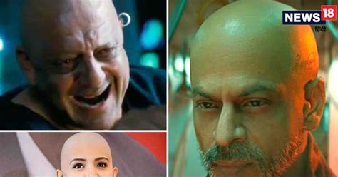 शाहरुख खान ही नहीं ये 5 सितारे भी स्क्रीन पर हो चुके हैं ‘गंजे