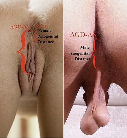 Anogenital Distance Wikipedia