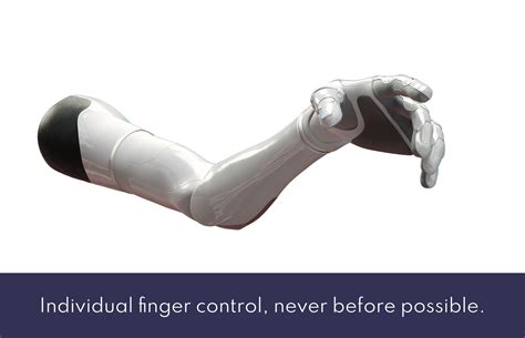 Atom Limbs Revolutionary Prosthetics To End Physical Disability 🦾 Wefunder Home Of The