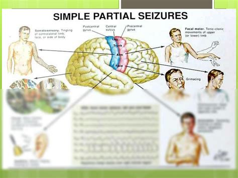 Solution Status Epileptikus Encelopati 2020 Dikonversi Studypool