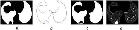 Contour Correction Example A Proposed Contour Correction Method Is