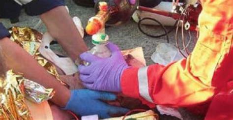 Factors That Make Emergency Intubation Difficult And The Rsi Sequence