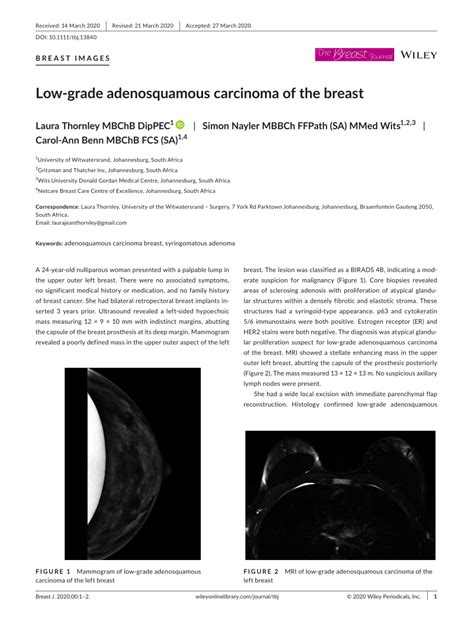 Pdf Low‐grade Adenosquamous Carcinoma Of The Breast