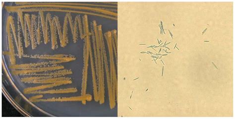 一株鞘氨醇单胞菌及其应用