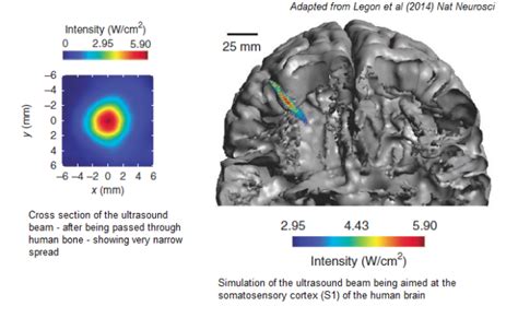 Is Ultrasonic Brain Stimulation The Future Discover Magazine