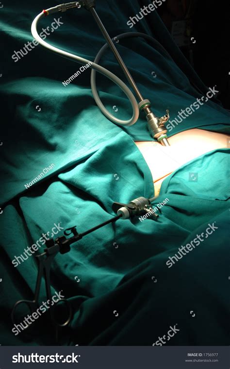 Demonstration Minimally Invasive Surgery Stock Photo Shutterstock