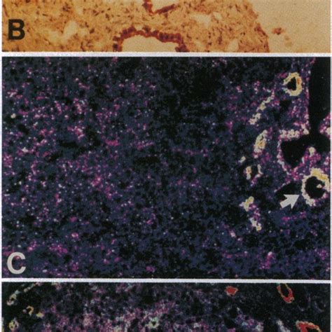 Micrographs Of Immunohistochemical Staining Of Bile Duct Epithelial