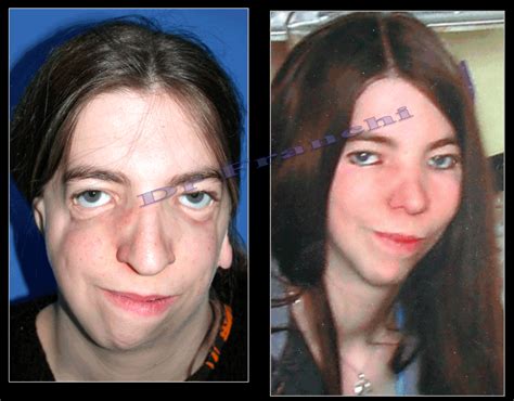 Chirurgie Réparatrice Et Plastique à Paris — Dr Gérald Franchi