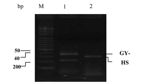 Agarose Gel Electrophoresis Analysis Of Dna Products Amplified