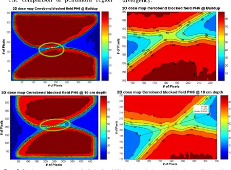 Figure 1 From Evaluation Of The Physical Characteristic Of Cerrobend Blocks Used For Radiation