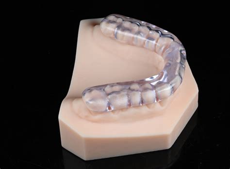 3d Printed Occlusal Splint Hard Occlusal Splint Golden Smile Dental Lab