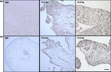 Higher Expression Of 14 3 3η⁺ And Fewer 14 3 3ɣ⁺ Cells Were Detectable Download Scientific