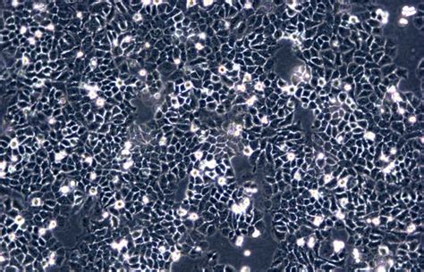 人宫颈癌细胞hela 229 Str鉴定正确 人源细胞 产品中心 上海瑾原生物科技有限公司