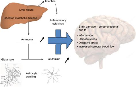 Acute Pediatric Hyperammonemia Current Diagnosis And Management Strat