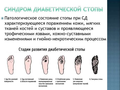 Поздние осложнения сахарного диабета - презентация онлайн