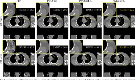 Sparse View X Ray Ct Reconstruction Using Ell 1 Prior With Learned Transform