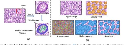 Figure 1 From Glandsam Injecting Morphology Knowledge Into Segment Anything Model For Label