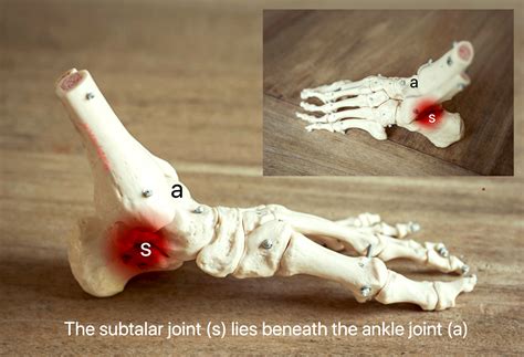 Subtalar Joint Fusion Surgery David Redfern Orthopaedic Surgery
