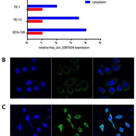 Mmp13 Mrna Expression Mean ± Sd In Normal And Cancerous Esophageal
