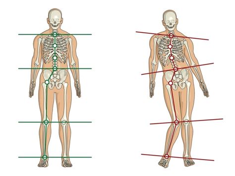 Body Alignment Over Royalty Free Licensable Stock Illustrations Drawings Shutterstock