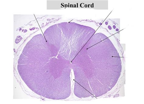 LABELING Spinal Cord 1 Q1 Diagram Quizlet