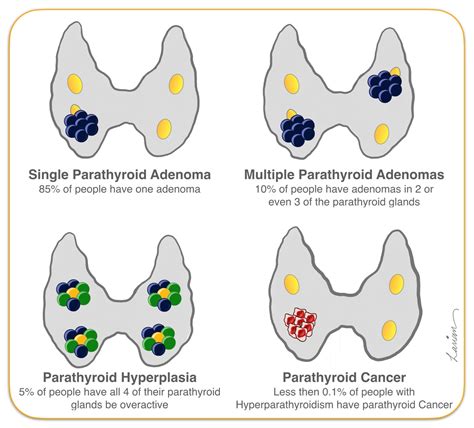 Parathyroid Gland Location