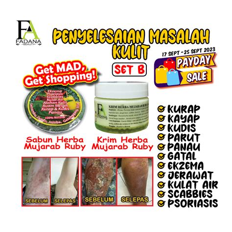 All Cream Masalah Kulit Gatal Eczema Fungus Ubat Kurap Krim Psoriasis