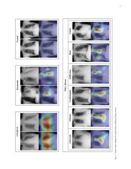Deep Learning For Screening COVID 19 Using Chest X Ray Images DeepAI