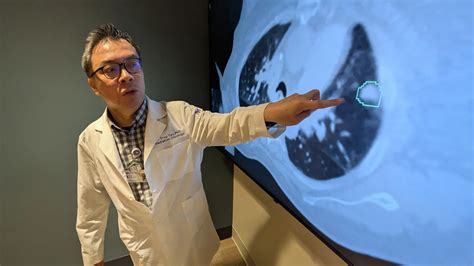 Ai Lung Tumor Tracking Early Detection And Lives Saved Archynewsy