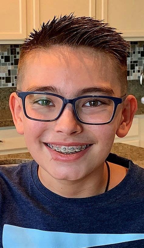 Pin By Bruce Nicolosi On Adult Braces Adult Braces Orthodontics Guys