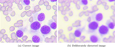 using super resolution for enhancing visual perception and segmentation