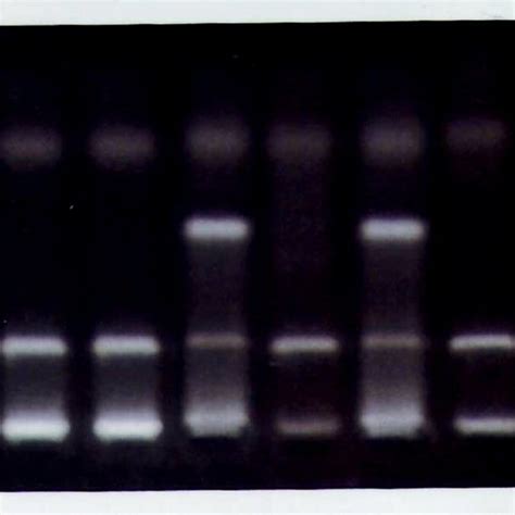 Results Of Pcr Amplification Of Sry Gene Showing Negative Results