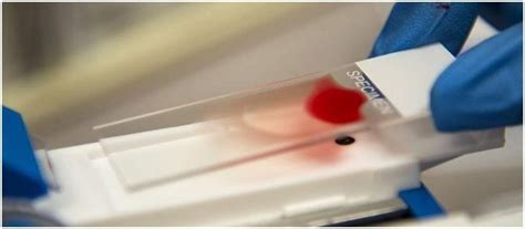 Blood Group Testing An Experiment To Determine The Blood Group
