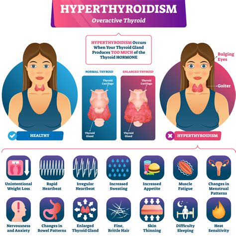 Thyroid Menstrual Cycle