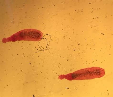 Echinococcus Spp Doccheck