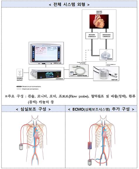 대안 없어 성인용 썼는데…소아 심장병 의료기기 허가