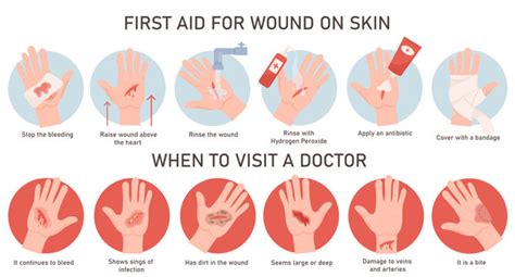 Bleeding First Aid Treatment