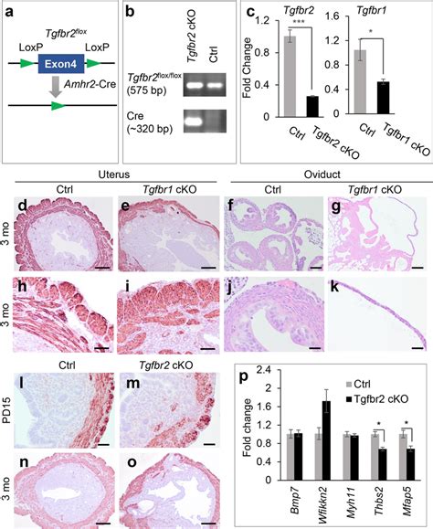 Loss Of Tgfbr2 Disrupts Myometrial Formation A Schematic