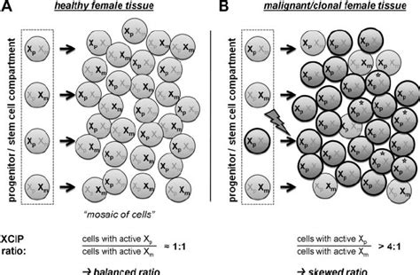 Principle Of X Chromosome Inactivation Patterns Xcip Analysis For