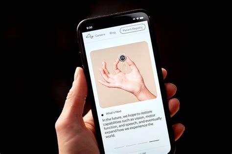 First Neuralink Human Trial Subject Can Control A Computer Mouse With Brain Implant Elon Musk