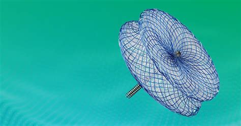 Amplatzer Ventricular Septal Defect Occluder Vsd Closure