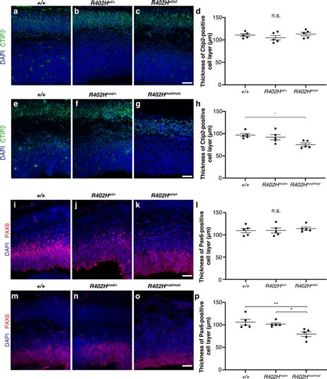 R402hmod R402hmod Embryos Have A Reduction In Ctip2 Positive Neurons Download Scientific