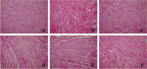 Effects Of Smi On The Pathological Morphology Of Myocardial Tissue He Download Scientific