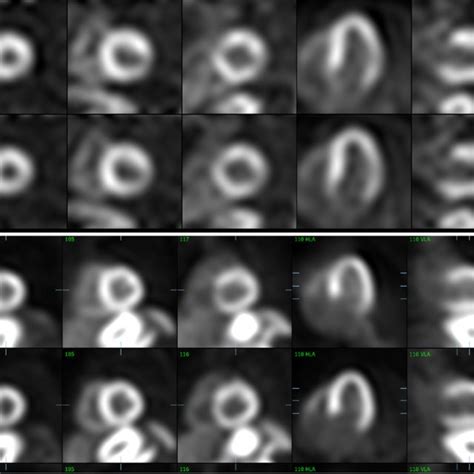 Displayed Above Are Two Examples Of Time Of Flight Reconstruction From Download Scientific