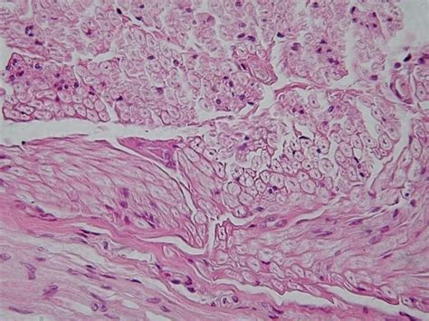 File Peripheral Nerve Cross Section  Wikimedia Commons