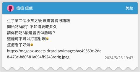 痘痘 痘疤 美妝板 Dcard