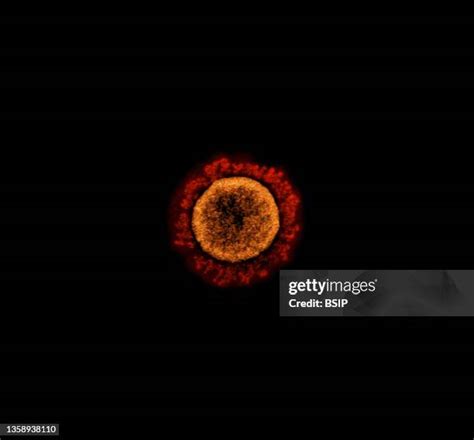 Virus Micrograph Photos And Premium High Res Pictures Getty Images