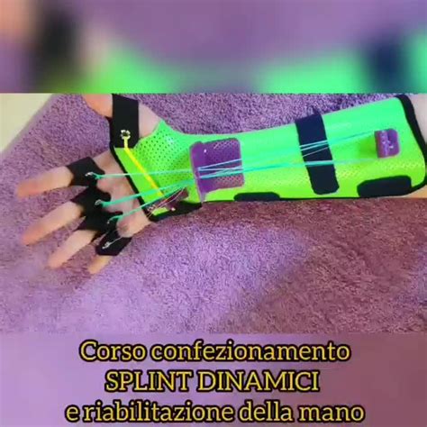 Livia Strugari On Linkedin Fisioterapiamano Handtherapy Strugari